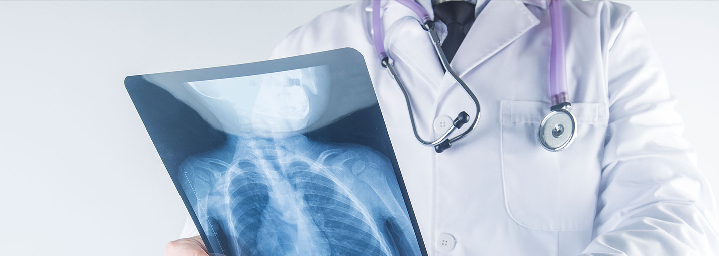 Hyperthermic Intrathoracic Chemotherapy (HITHOC) and Mesothelioma - The ...