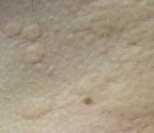 Asbestos rash Archives - The Law Offices of Justinian C. Lane, Esq. – PLLC